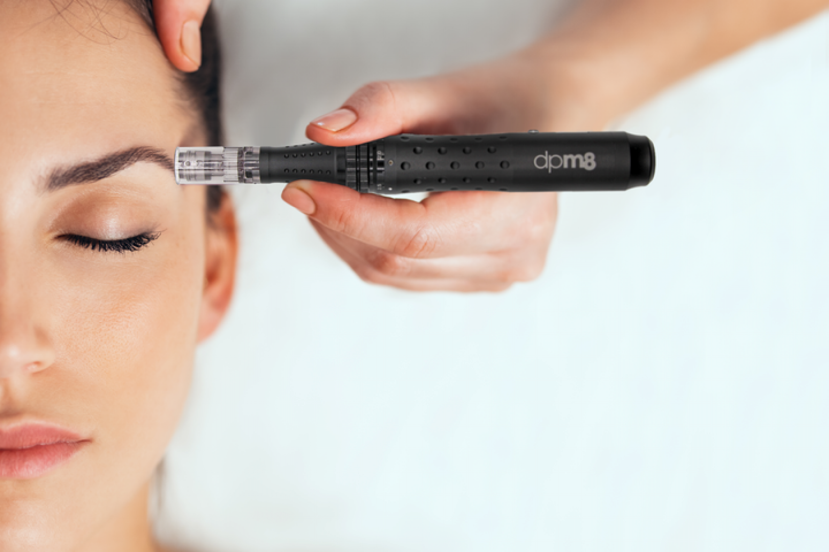 Microneedling • Luciderm Aesthetics